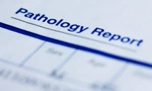 How to Properly Read a Pathology Report - Pink Lotus Power Up