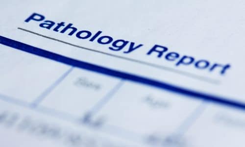 How to Properly Read a Pathology Report - Pink Lotus Power Up